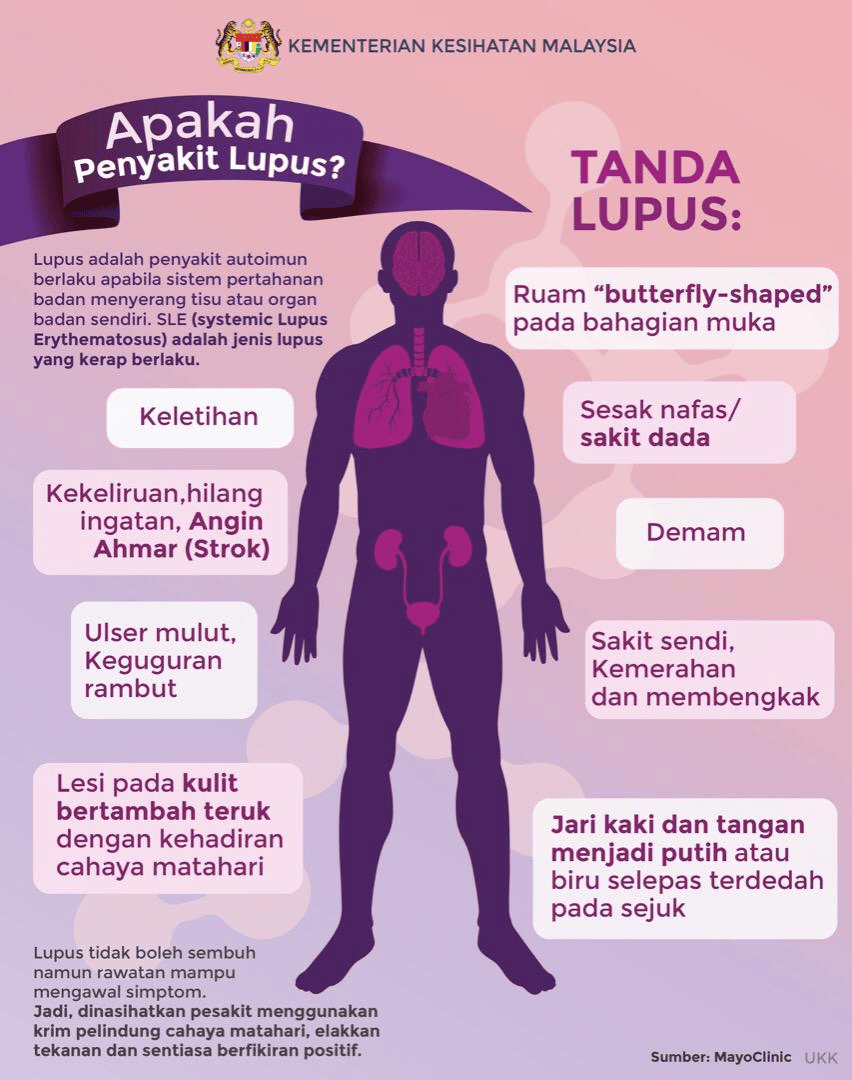 Penyakit Sistemik Lupus Erythematosus (SLE) - Tips Kesihatan